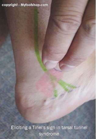 Blog | MyFootShop.com